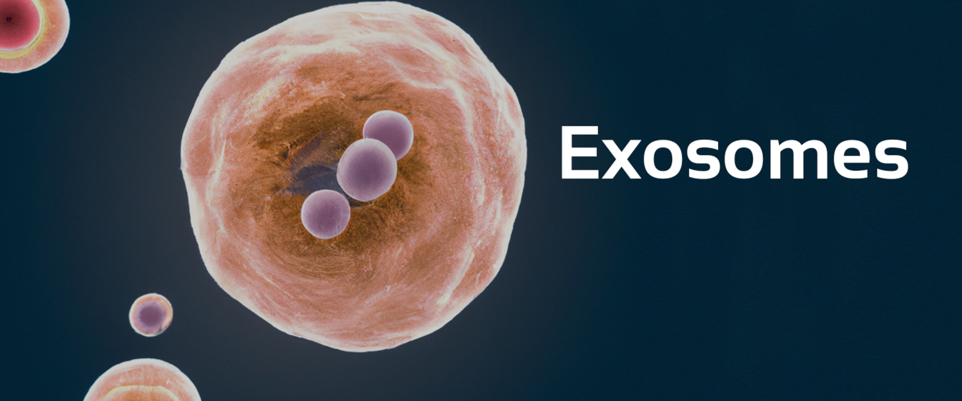 The Potential of Exosomes in Disease: An Expert's Perspective