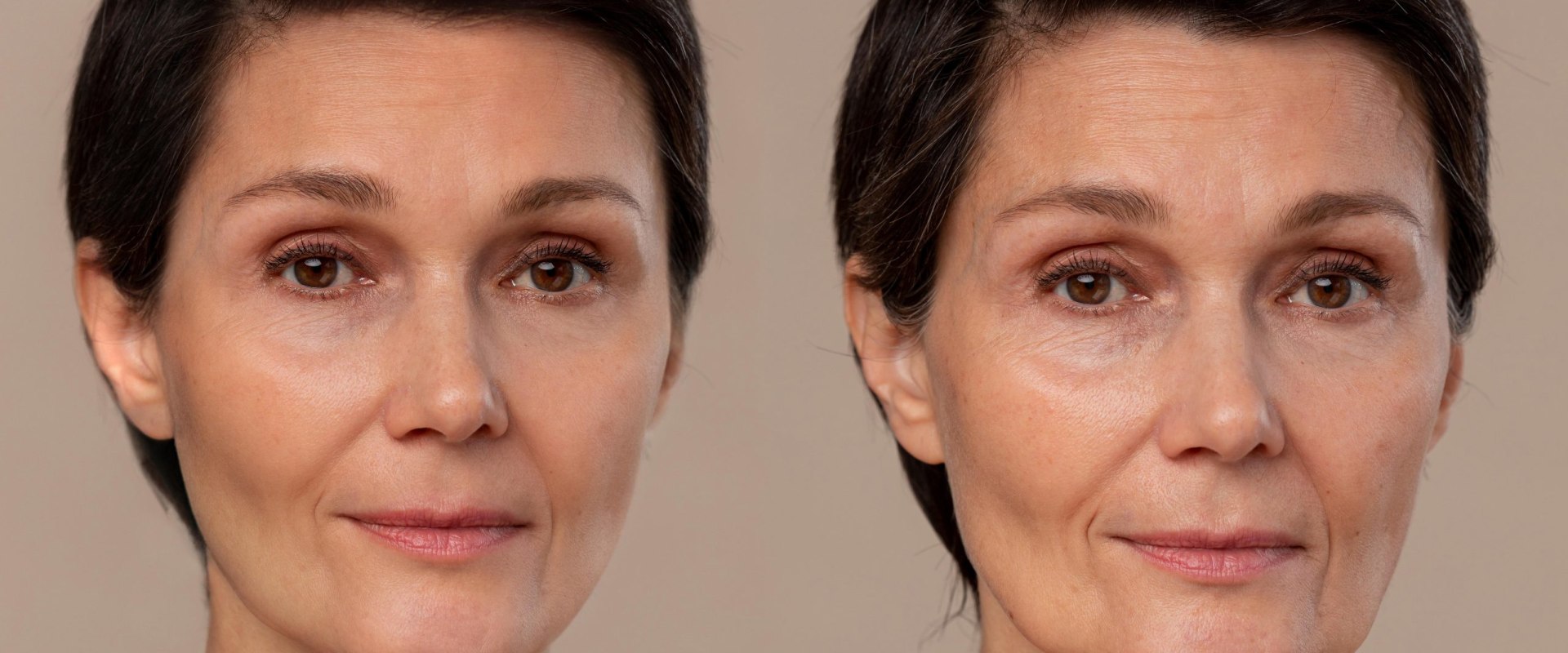 What do exosomes do to your face?